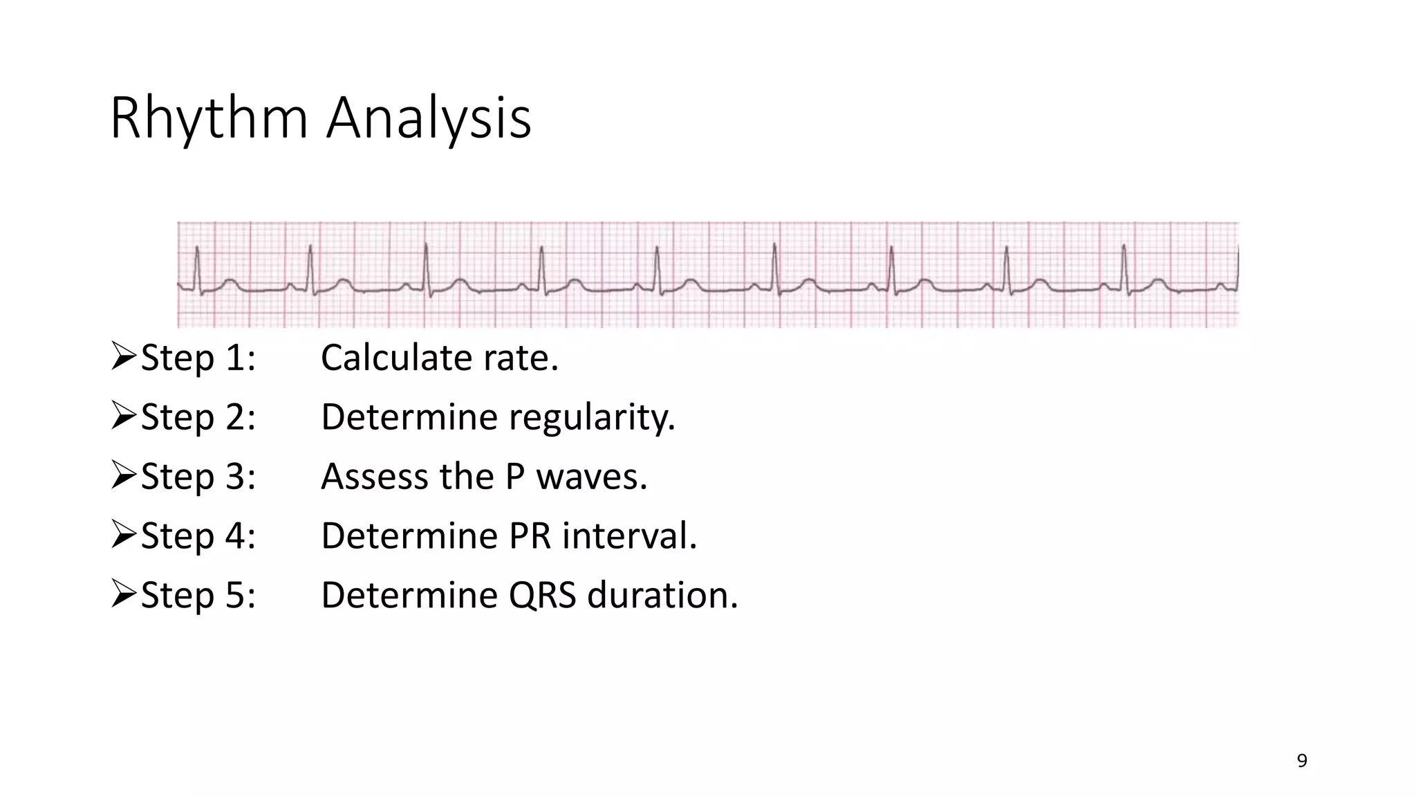 ECG-Interpretation-ppt-for-student.pptx