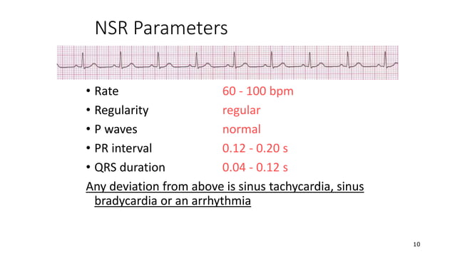 ECG-Interpretation-ppt-for-student.pptx