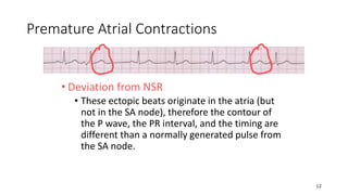 ECG-Interpretation-ppt-for-student.pptx