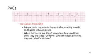 ECG-Interpretation-ppt-for-student.pptx