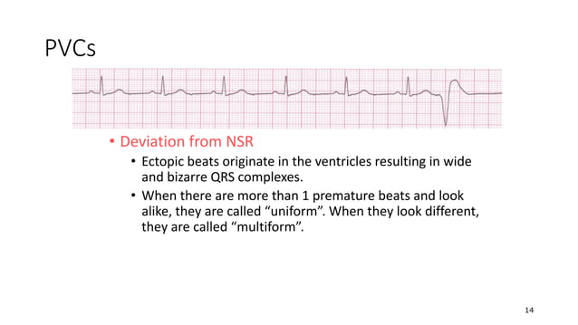 ECG-Interpretation-ppt-for-student.pptx