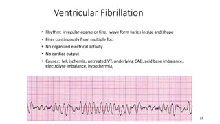 ECG-Interpretation-ppt-for-student.pptx