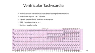 ECG-Interpretation-ppt-for-student.pptx