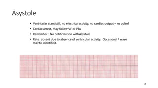ECG-Interpretation-ppt-for-student.pptx