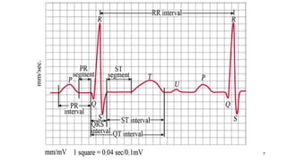 ECG-Interpretation-ppt-for-student.pptx