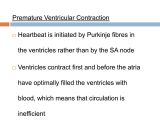 ECG - Junctional Arrhythmia & Ventricular Arrhythmia | PPTX