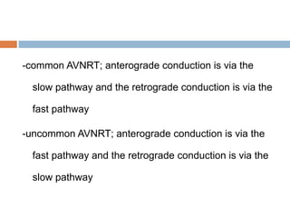 ECG - Junctional Arrhythmia & Ventricular Arrhythmia | PPTX