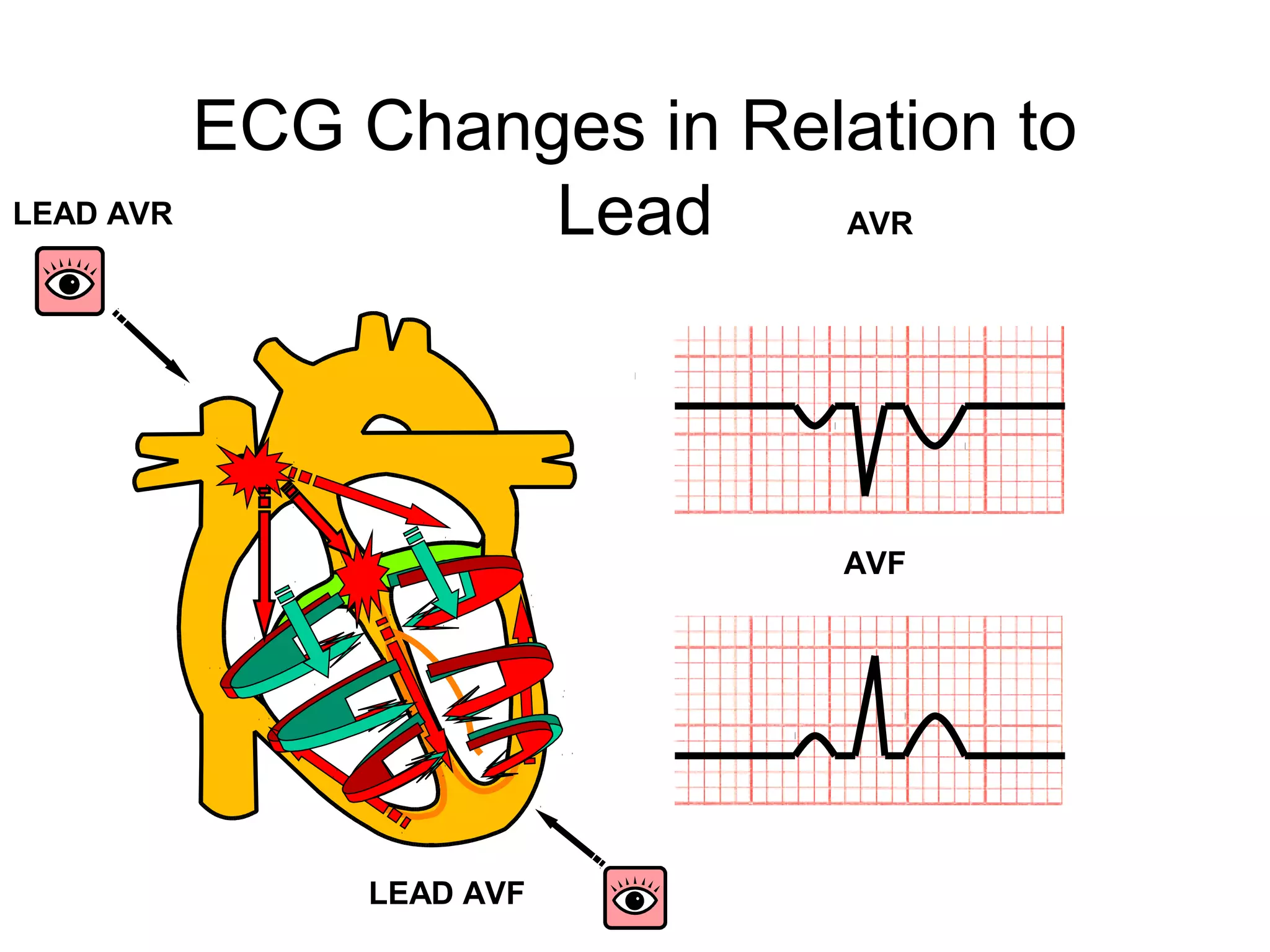 ECG leads | PPT