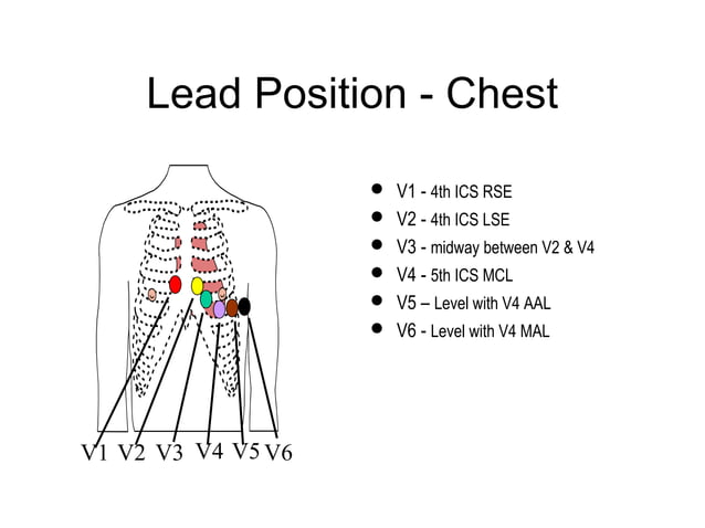 ECG leads | PPT | Heart and Cardiovascular Diseases | Diseases and ...
