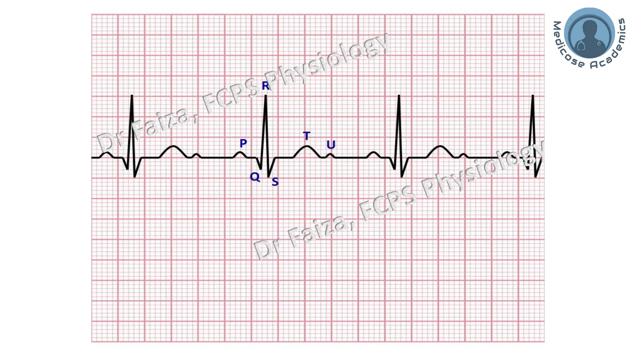 Electrocardiogram (ECG) physiological basis .pdf