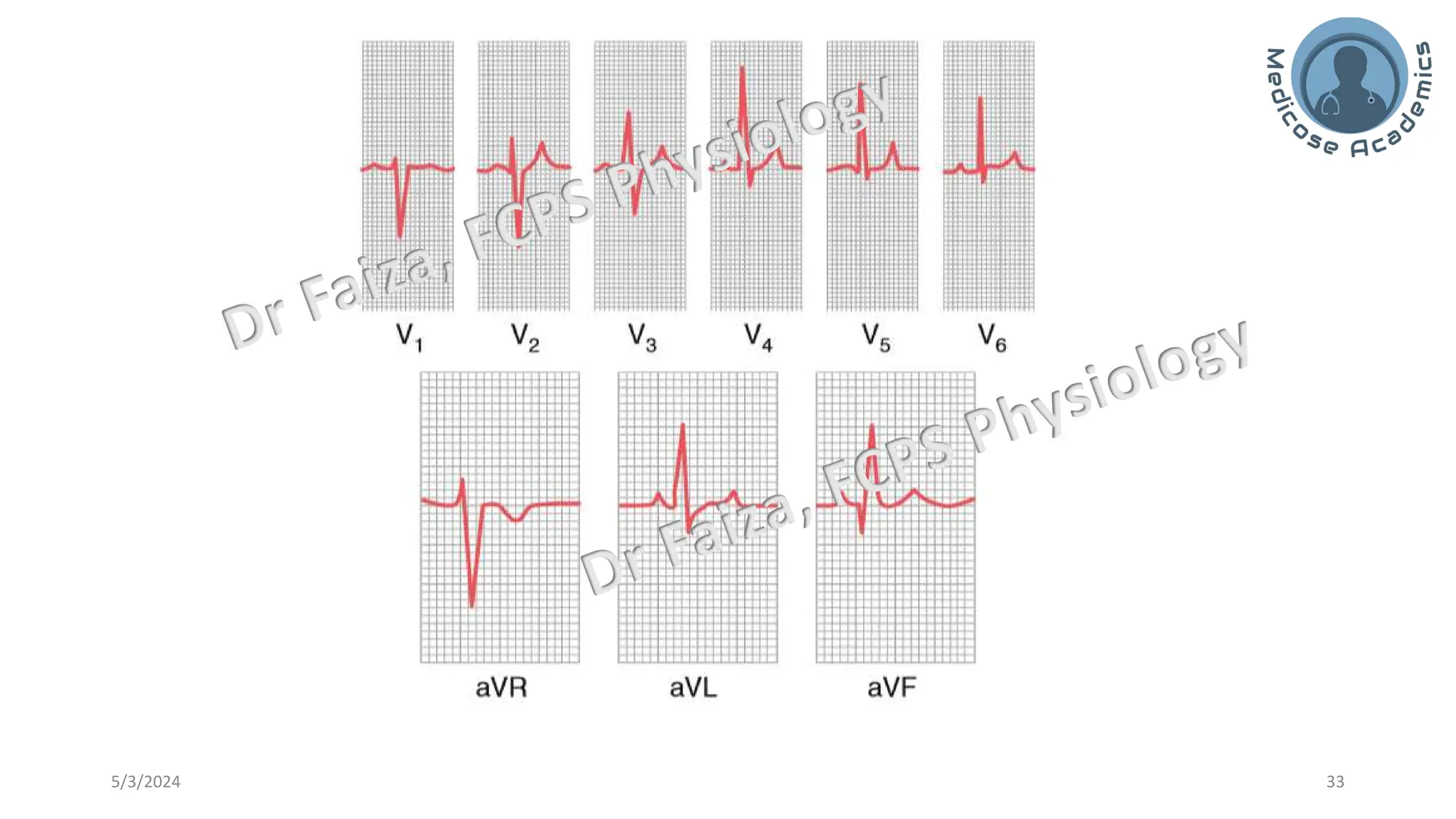 Electrocardiogram (ECG) physiological basis .pdf