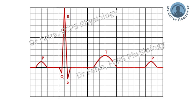 Electrocardiogram (ECG) physiological basis .pdf