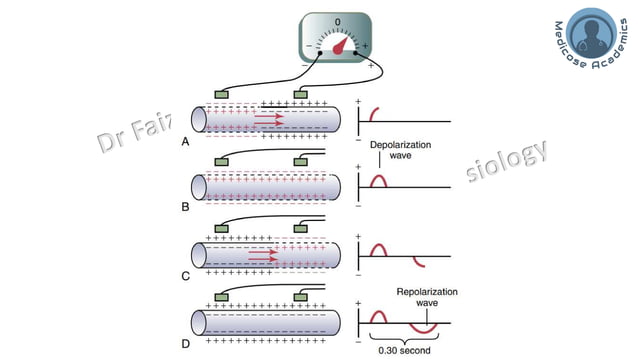 Electrocardiogram (ECG) physiological basis .pdf
