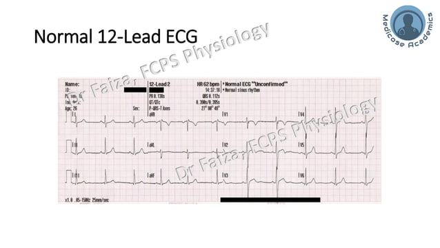 Electrocardiogram (ECG) physiological basis .pdf