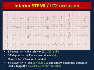 Myocardial Ischemia and Infarction | PPTX