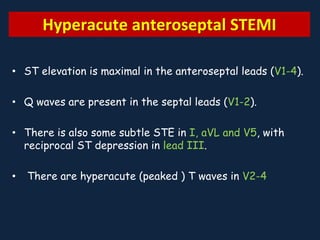 Myocardial Ischemia and Infarction | PPTX