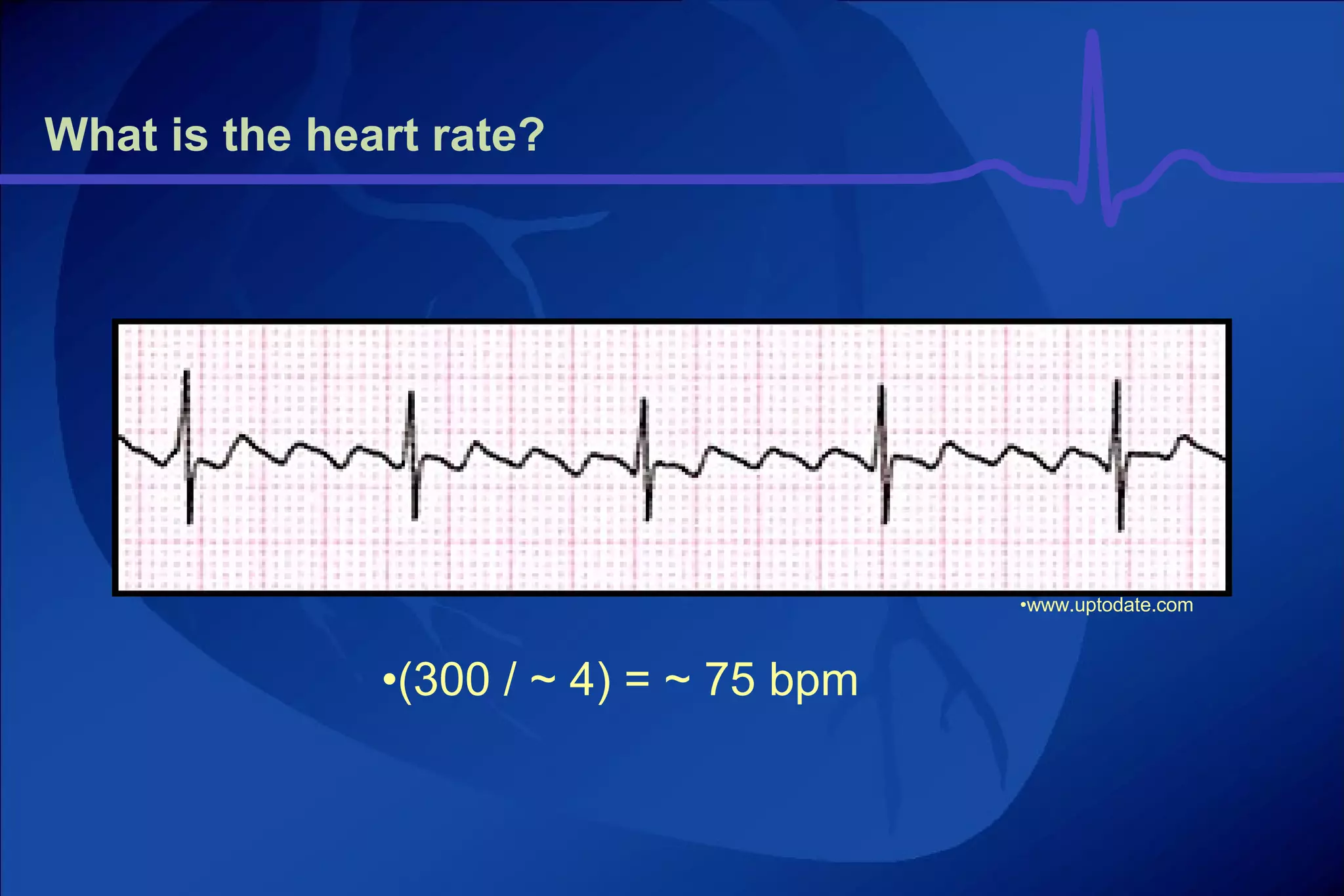 Ecg Part 1 | PPT