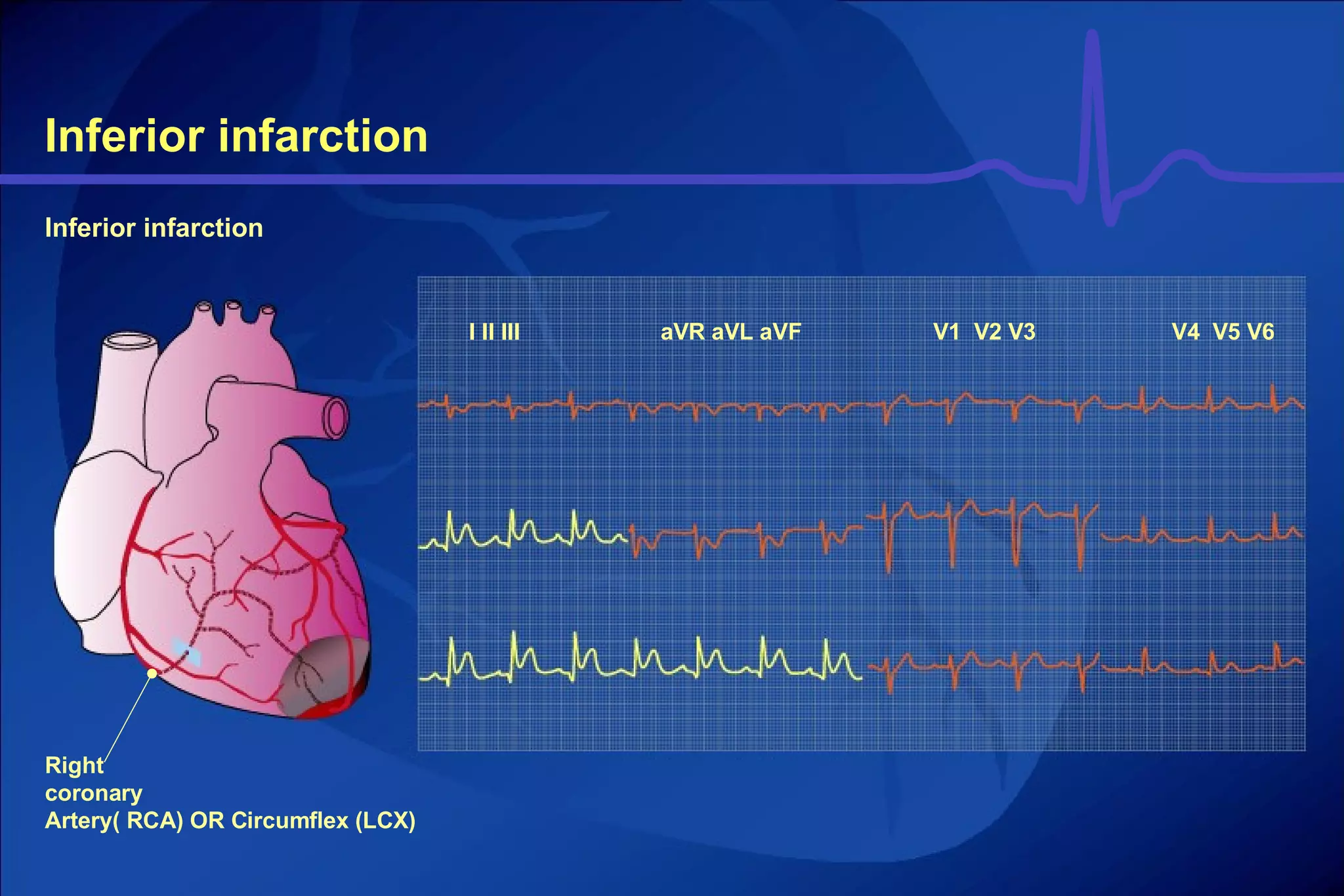 Ecg Part 1 | PPT