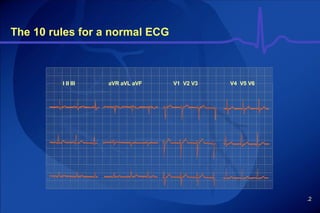 Ecg Part 1 | PPT