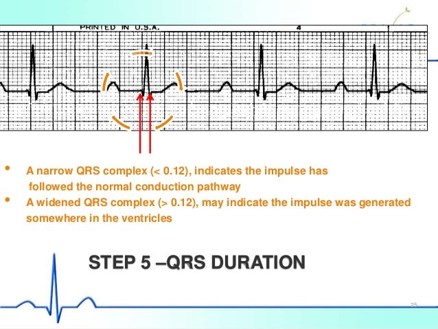 Ecg