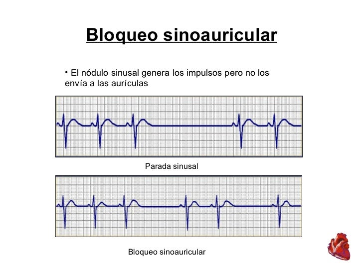 Electrocardiografia inicial