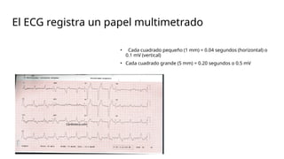 ECG - Presentacion de componentes de ECG.pptx