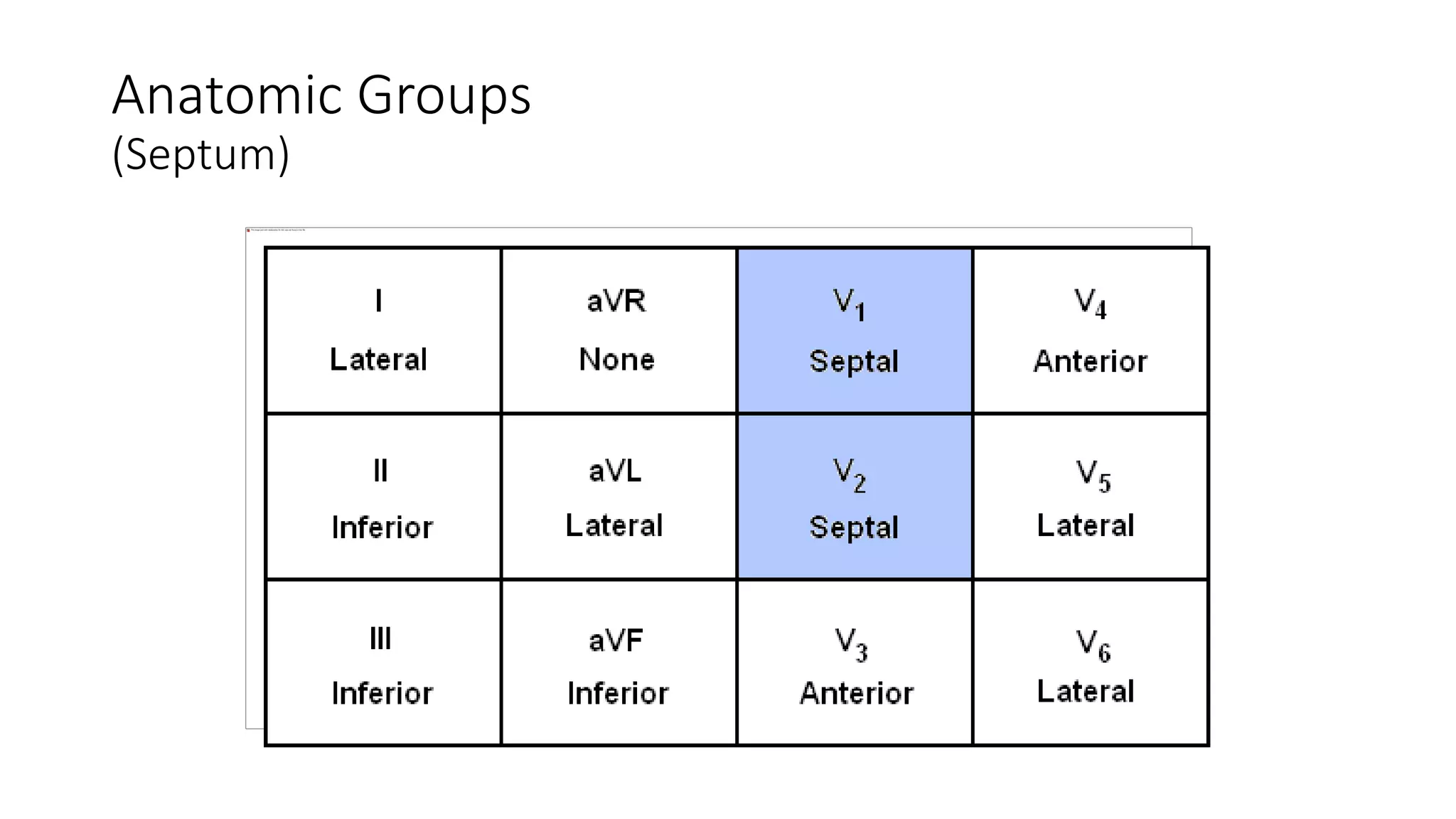 ECG-REVISION.pptx