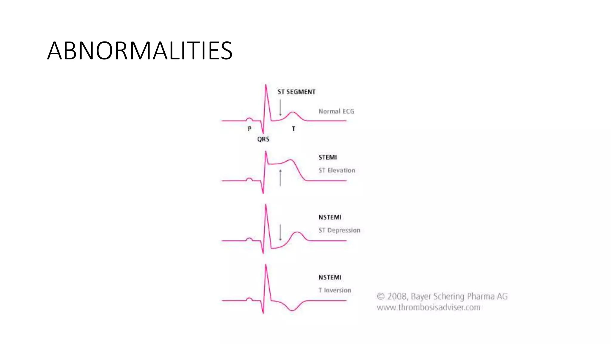 ECG-REVISION.pptx