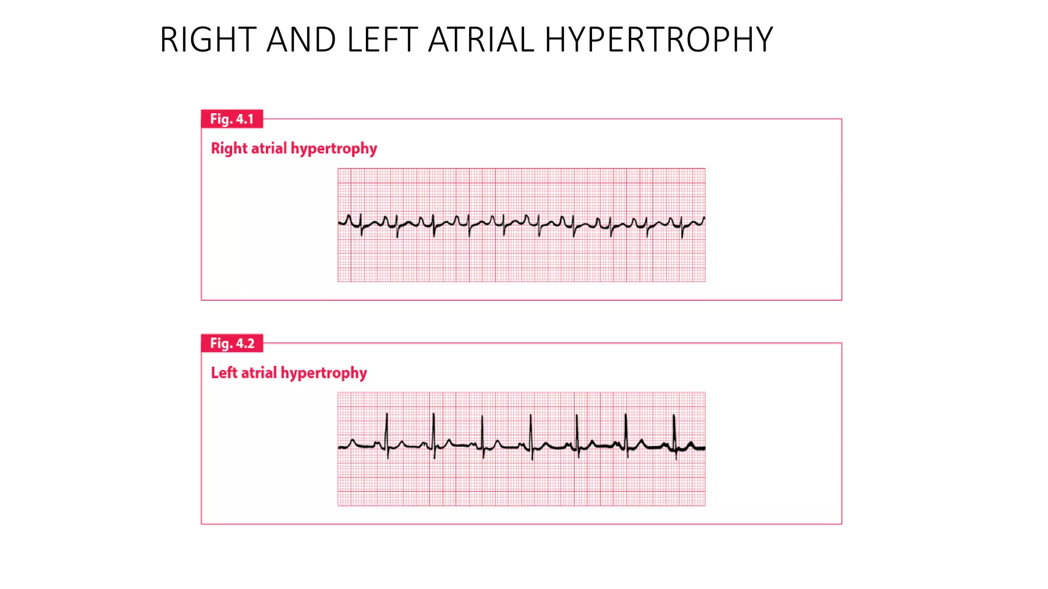 ECG-REVISION.pptx