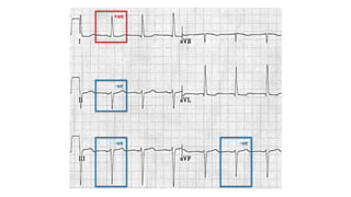 ECG-REVISION.pptx