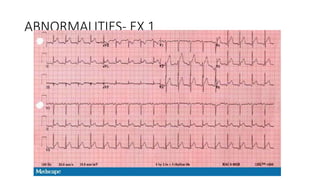 ECG-REVISION.pptx