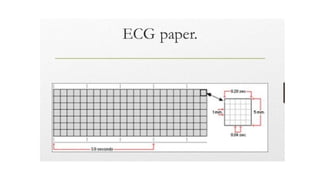 ECG-REVISION final yr physiotherapy .pptx