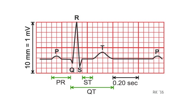 ECG-REVISION final yr physiotherapy .pptx