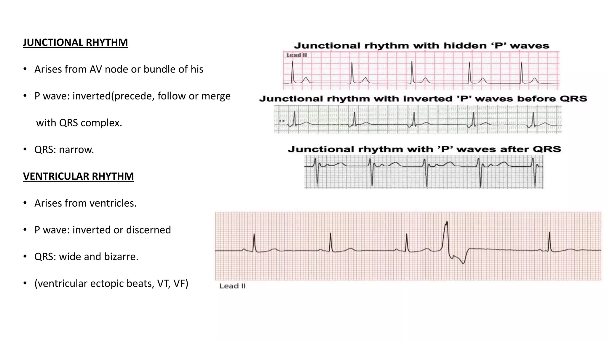 Ecg made easy | PPTX