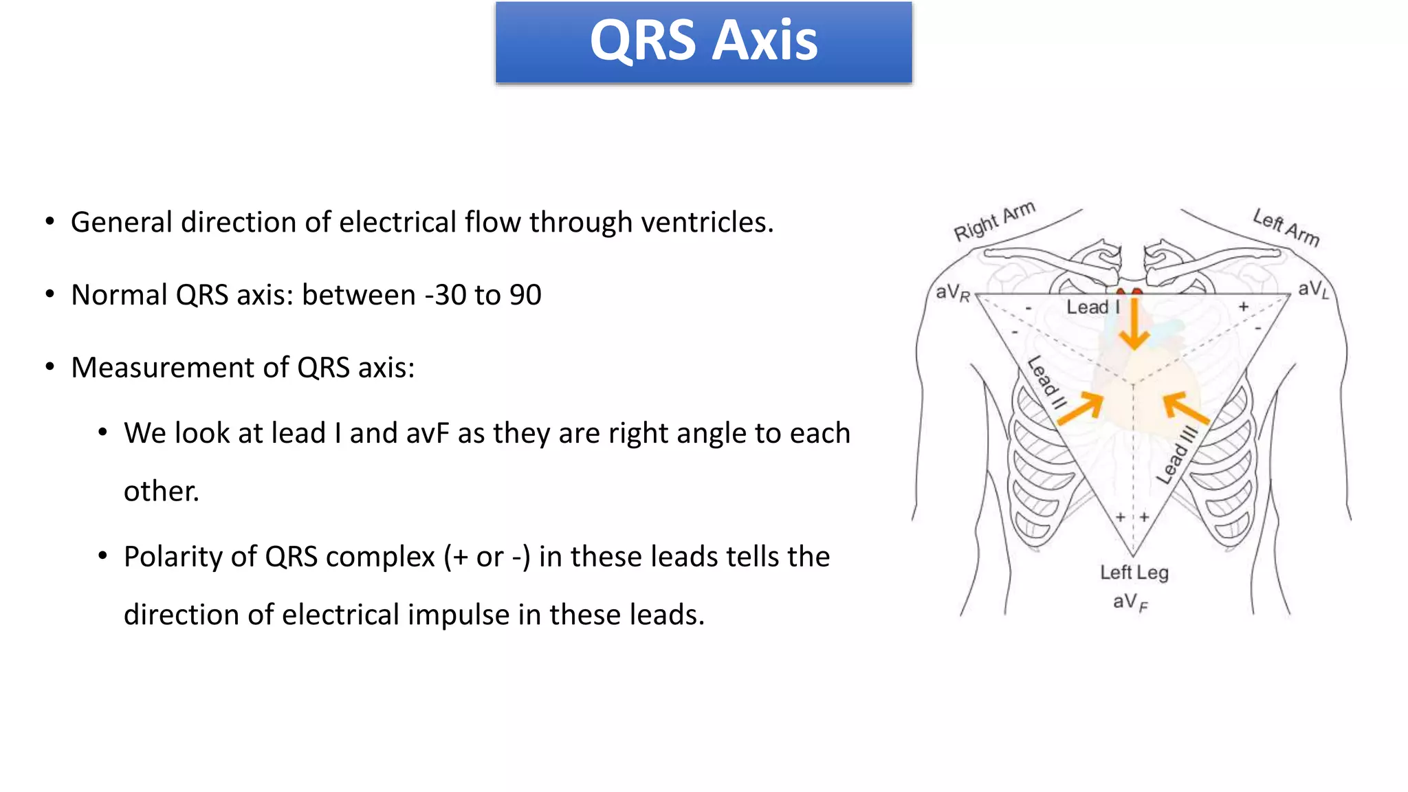 Ecg made easy | PPTX
