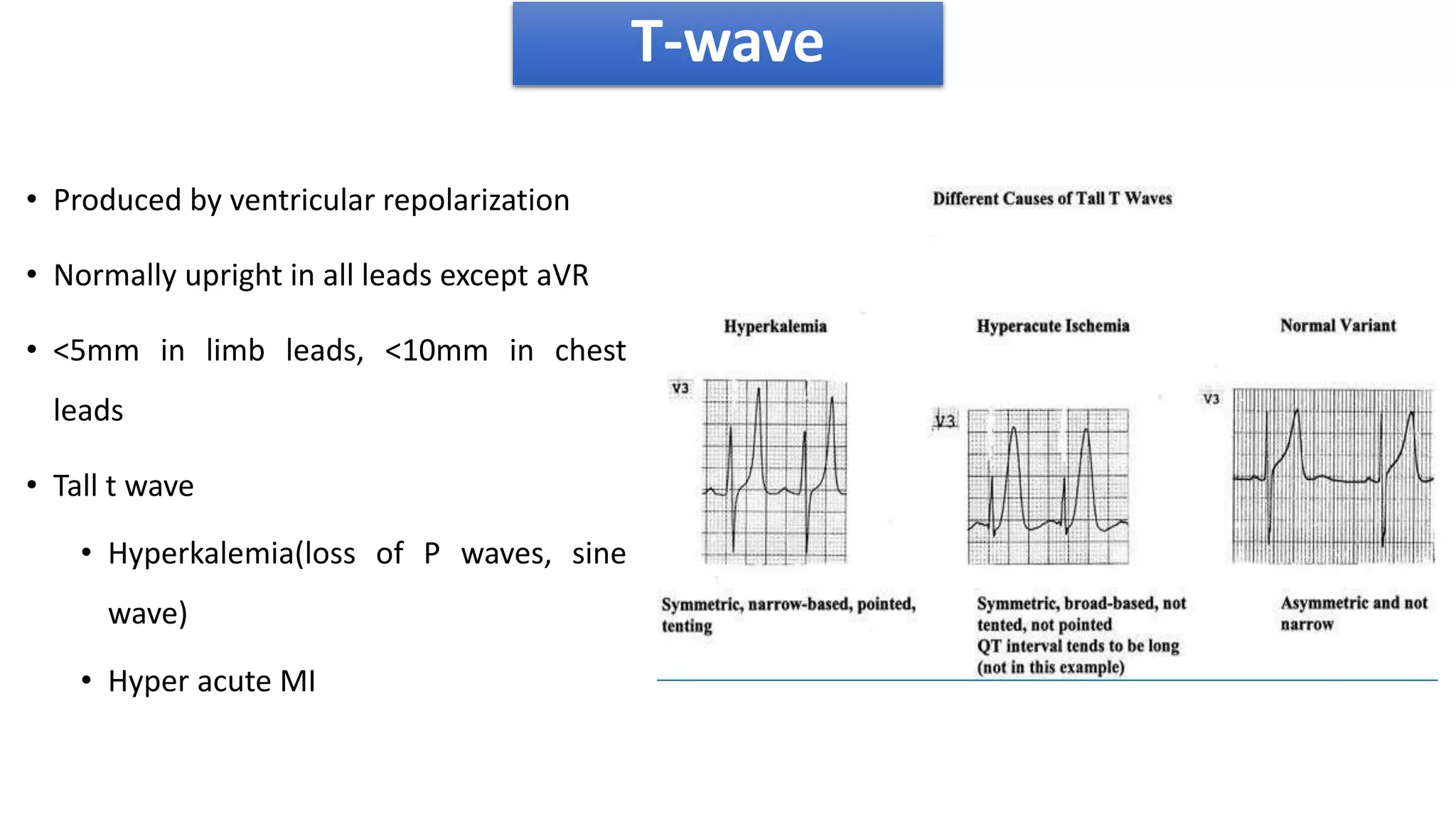 Ecg made easy | PPTX
