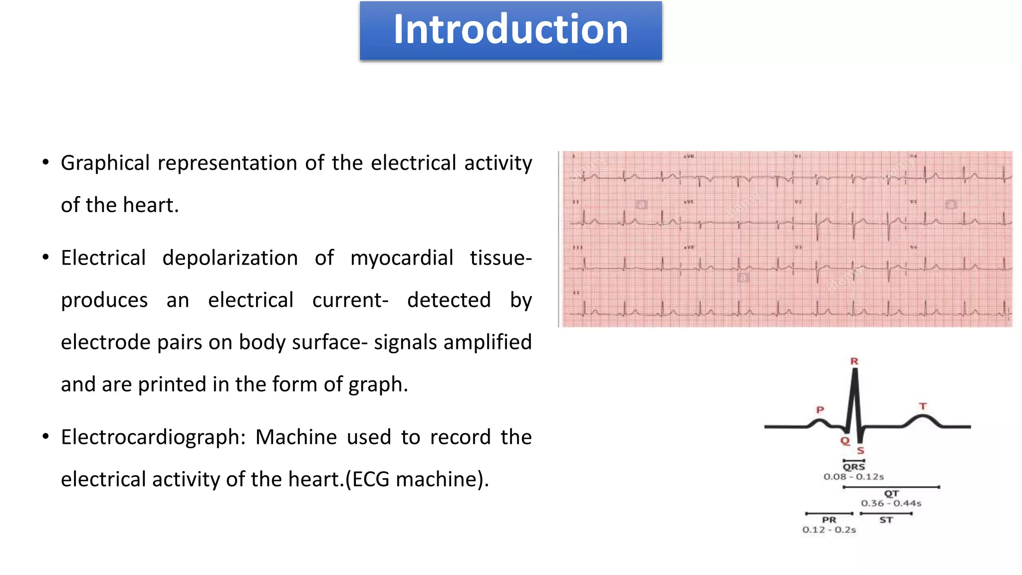 Ecg made easy | PPTX