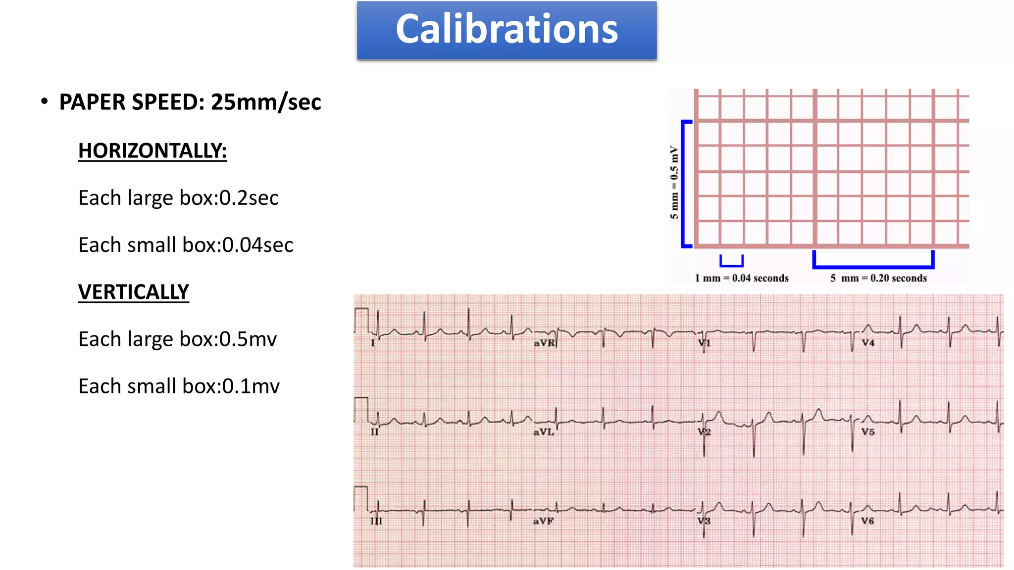 Ecg made easy | PPTX