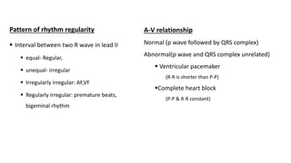 Ecg made easy | PPTX