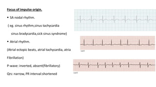Ecg made easy | PPTX