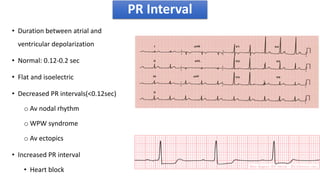 Ecg made easy | PPTX