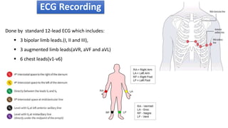 Ecg made easy | PPTX