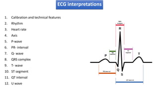 Ecg made easy | PPTX