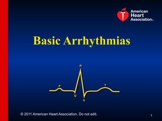 ECG-Slide-Set.pptx the basics of ECG reading | PPTX