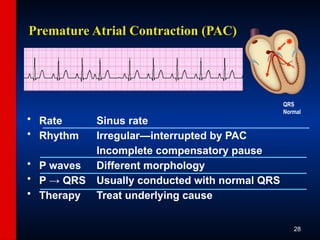 ECG-Slide-Set.pptx the basics of ECG reading | PPTX
