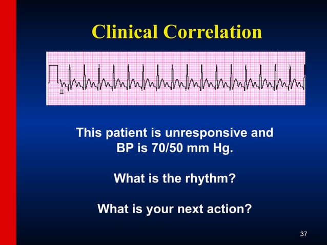 ECG-Slide-Set.pptx the basics of ECG reading | PPT