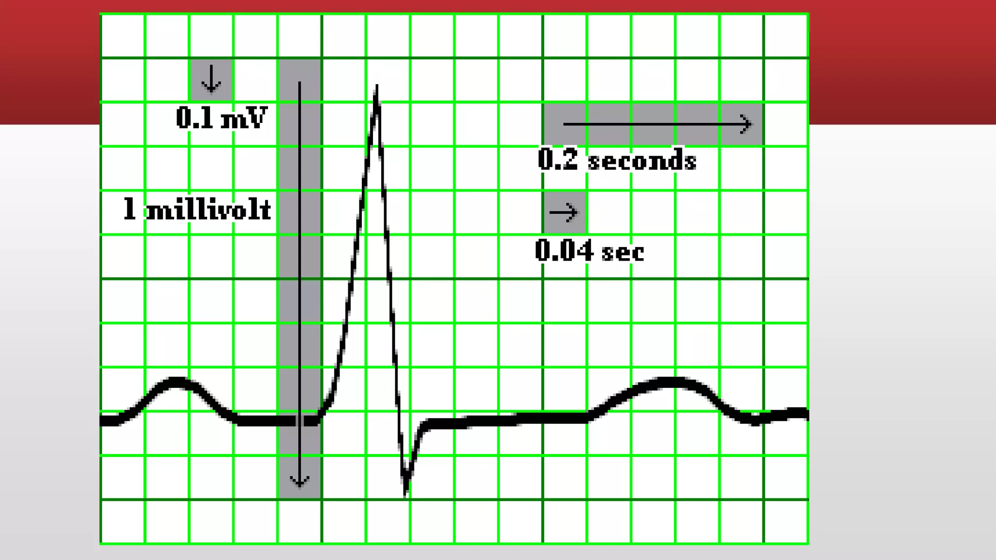 Basics of electrocardiogram | PPT
