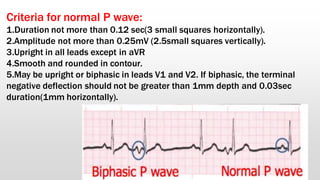 Basics of electrocardiogram | PPT