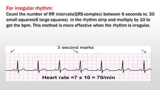 Basics of electrocardiogram | PPT