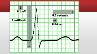 Basics of electrocardiogram | PPT